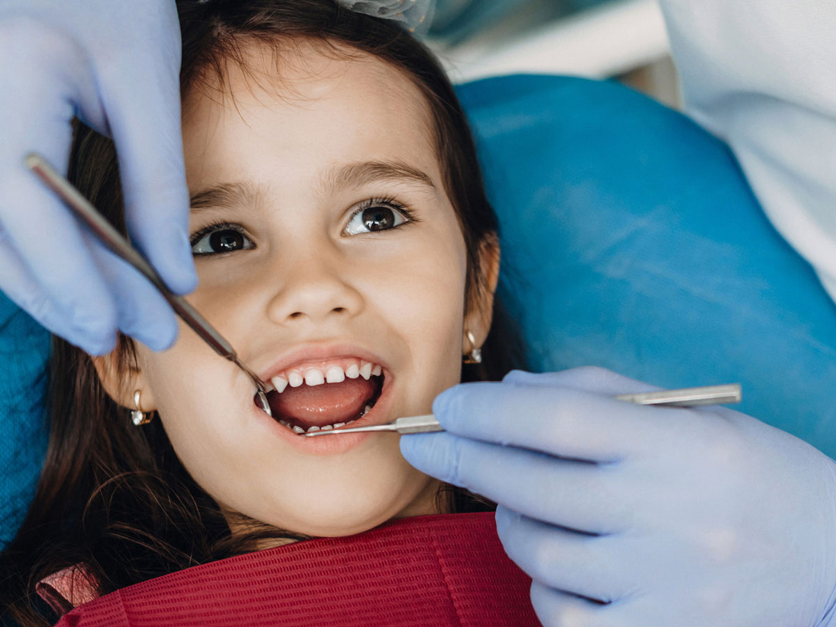Prevention of Tooth Decay - Mason Square Dental